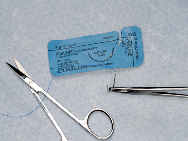 Blink Activity | BlinkLearning