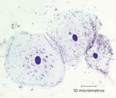 Blink Activity | BlinkLearning