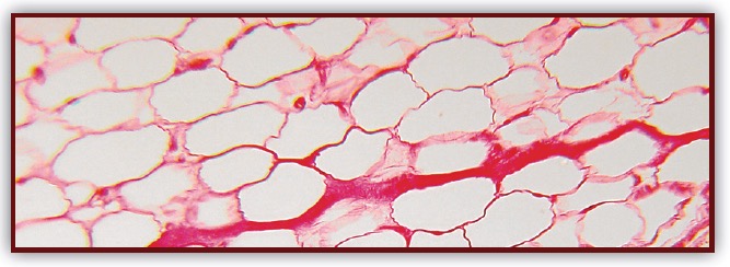 Blink Activity | BlinkLearning