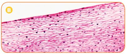 Blink Activity | BlinkLearning