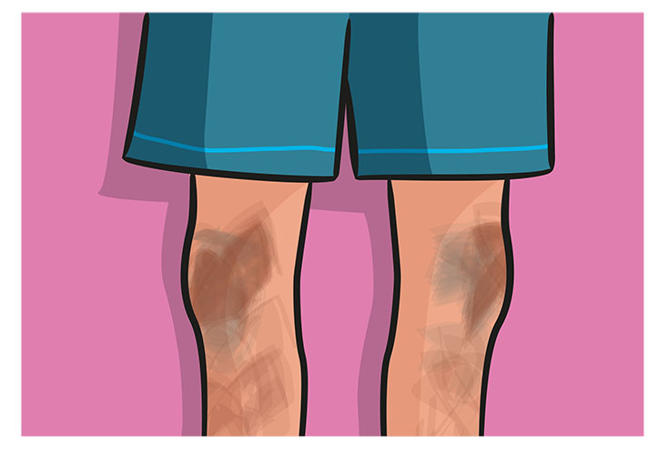 Blink Activity | BlinkLearning